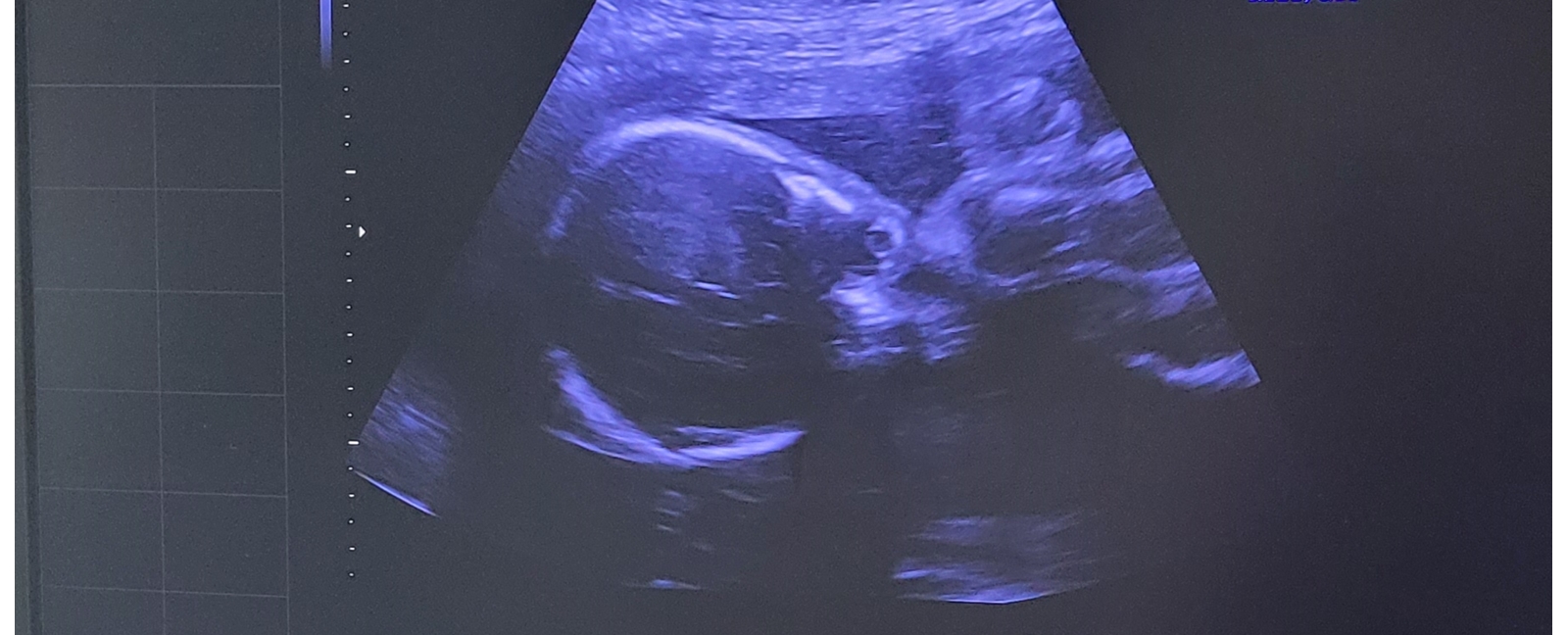 Big News in the Professor Game Family! | Episode 255 – Professor Game